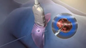 Cardio Workouts: Keep Your Heart Healthy & Strong